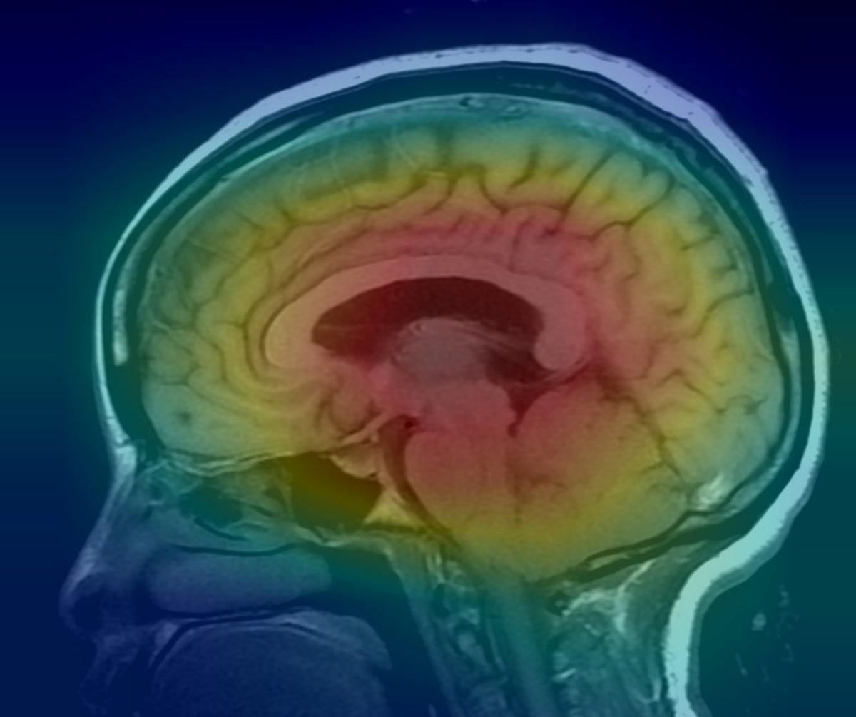 Machine Learning and Artificial Intelligence – Johns Hopkins Malone ...