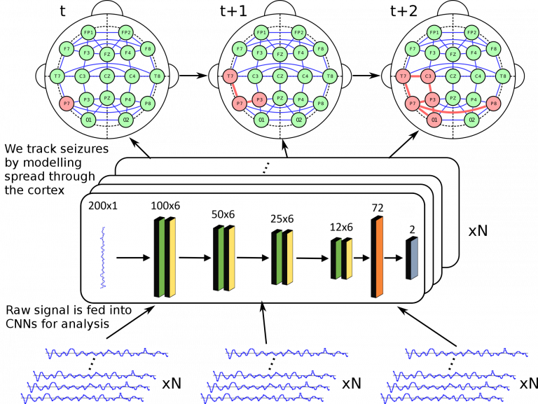 Noninvasive Localization Of Epileptic Seizures Johns Hopkins Malone
